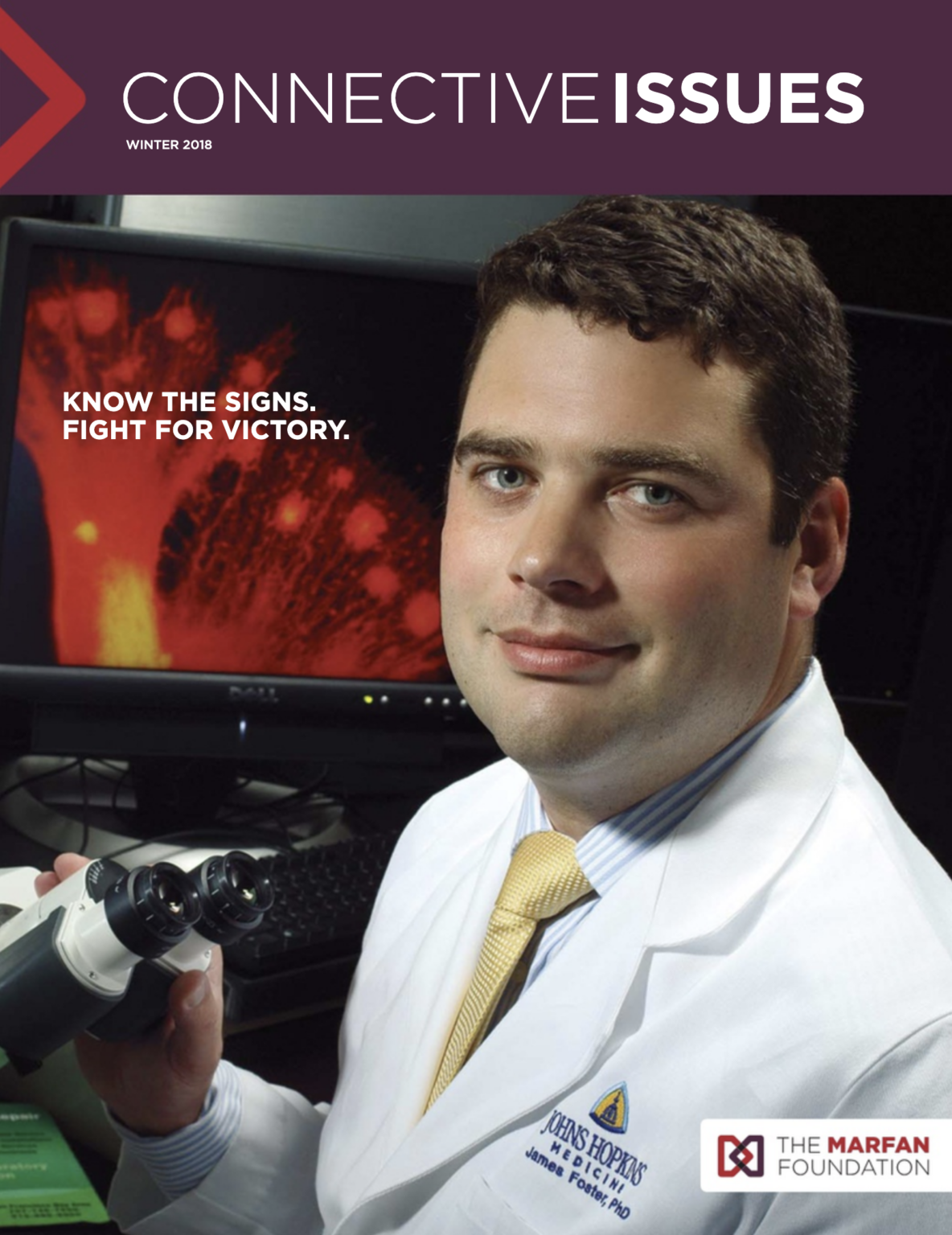 Connective Issues - Marfan Foundation